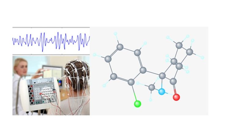 Ketamine and Brain Waves | BioSerendipity