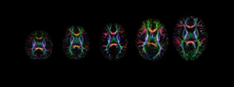 Neuron and Glia Remodeling in Male Behavior | BioSerendipity